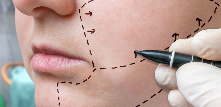 Marcas no rosto: É possível melhorar com cirurgia? - CBN Londrina - A ...